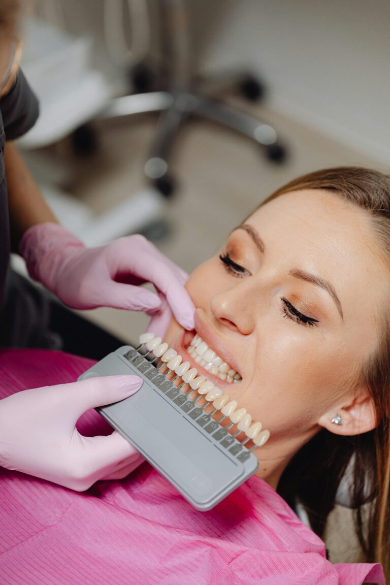 Transform Your Smile: The Ultimate Guide to Smile Dental Whitening ...